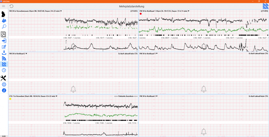 Digitale CTG-Überwachung - Digitalisierung im Gesundheitswesen