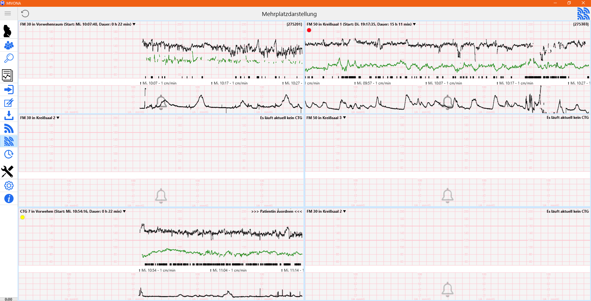 Digitale CTG-Überwachung - Digitalisierung im Gesundheitswesen